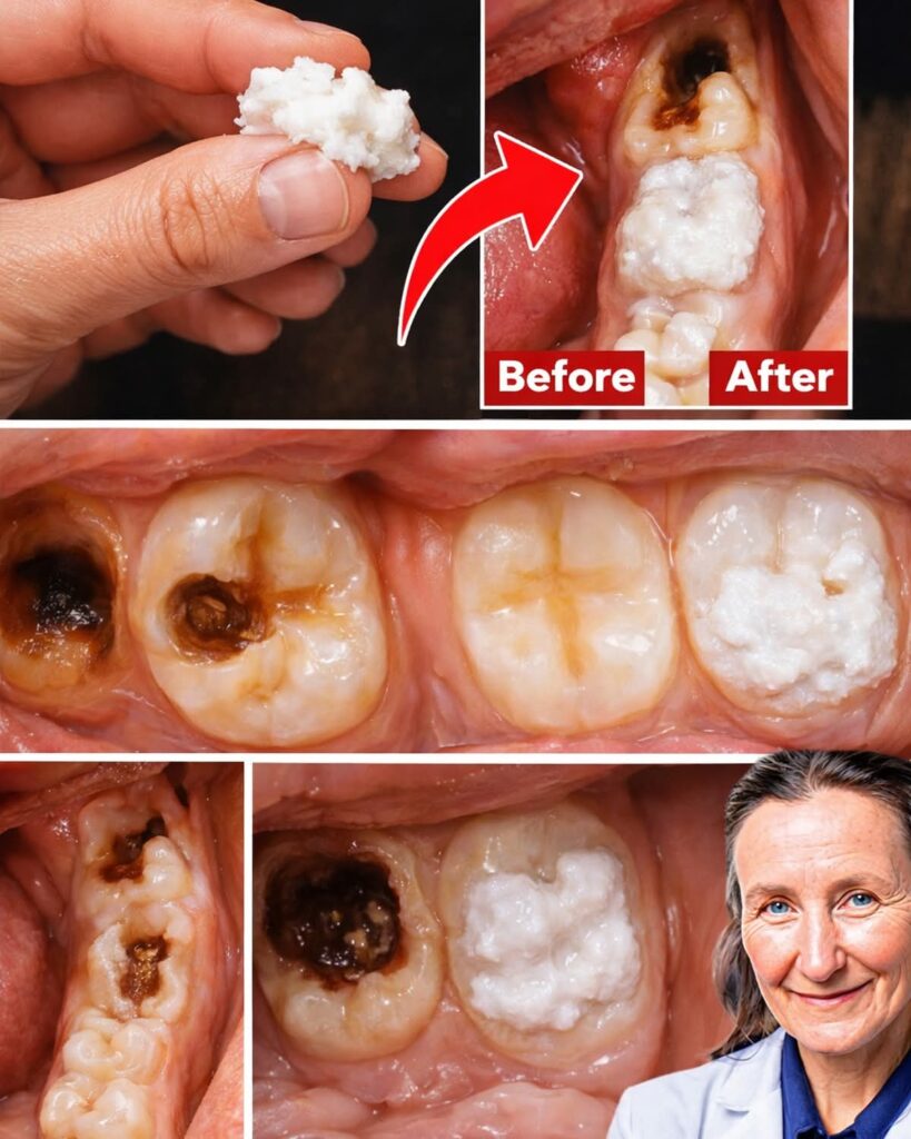 Keep these tips in mind to avoid visiting the dentist How to naturally ...
