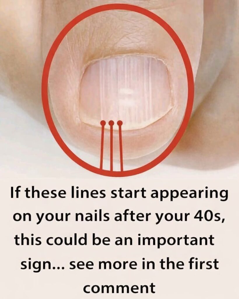 If Lines Start Appearing on Your Nails After Age 40, This Could Be…